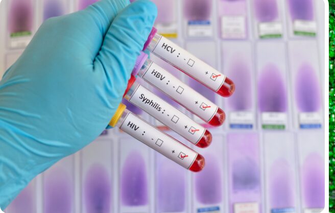 Rising STI Rates Among Kenyan Adolescents: A Call for Improved ...